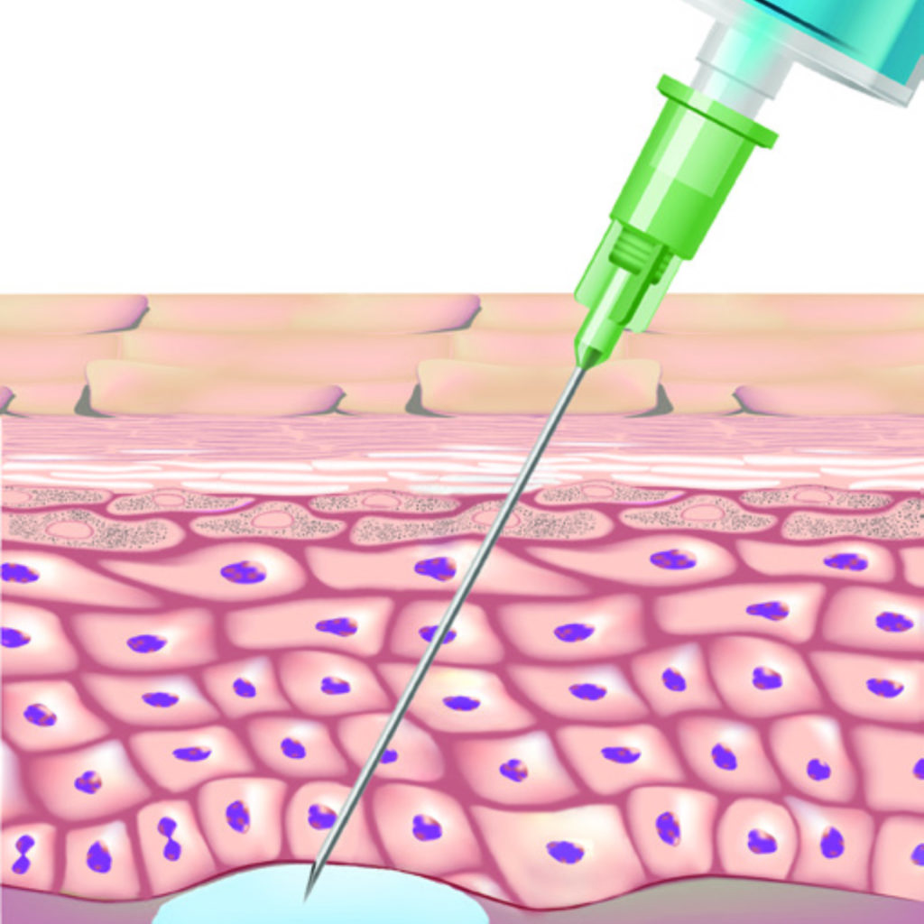 #infuzion® | #diekunstmühle.